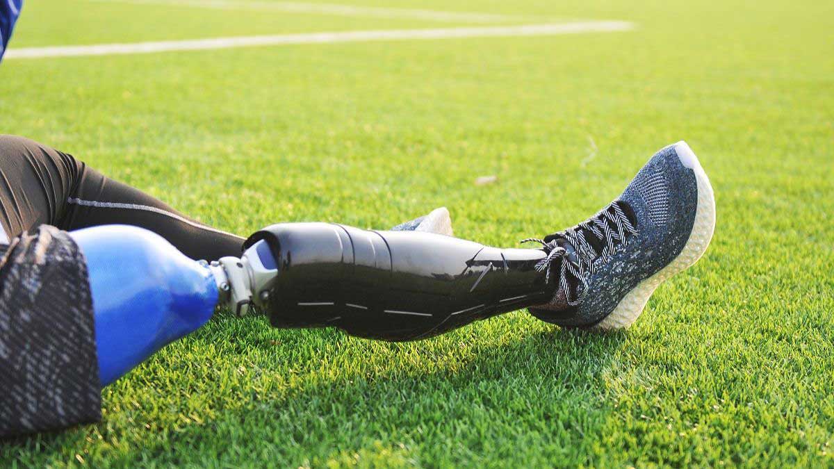 Prosthetics Shell ประยุกต์โดยการสแกน 3 มิติและการพิมพ์ 3 มิติ | ศูนย์ ...